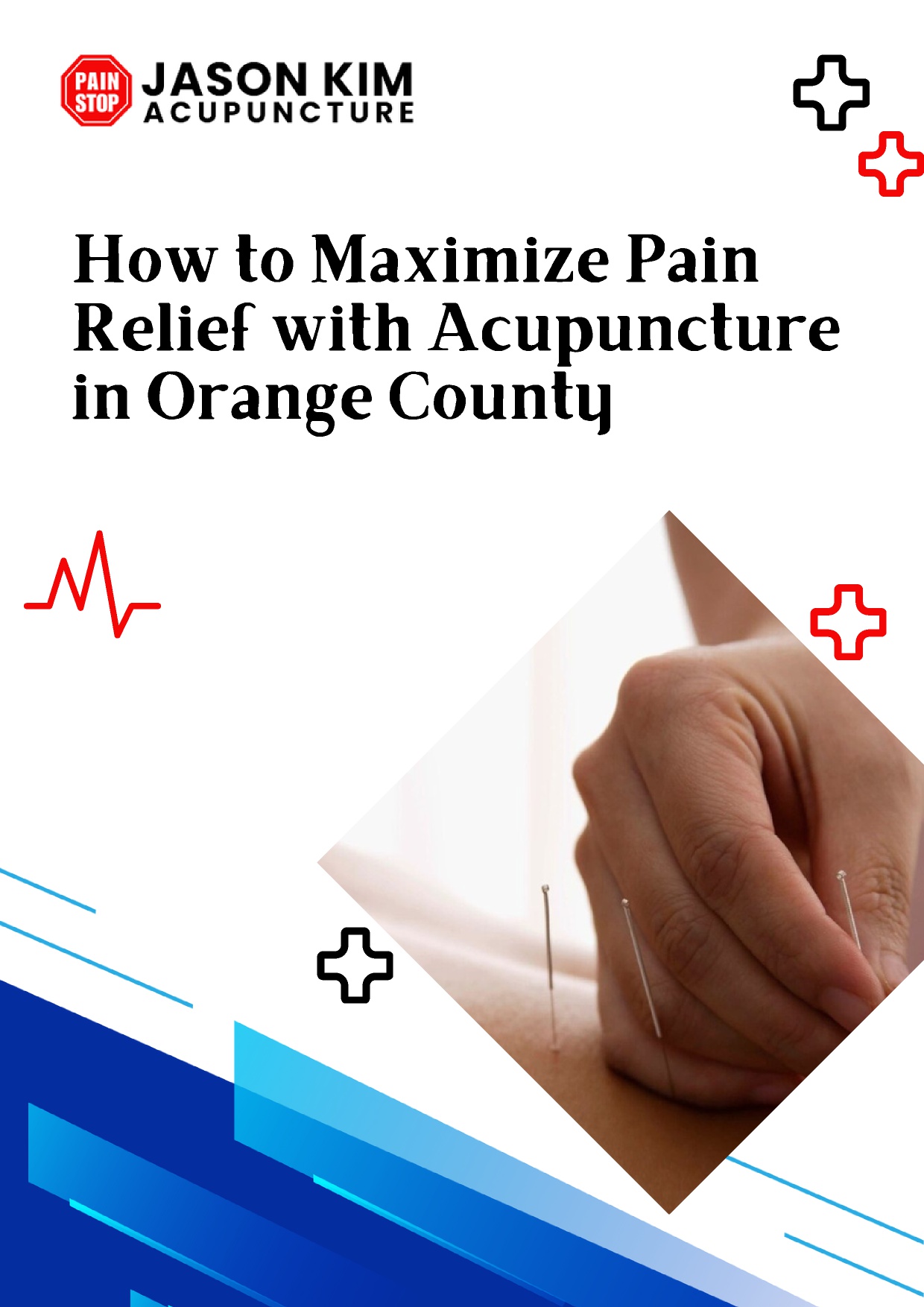 How to Maximize Pain Relief with Acupuncture in Orange County